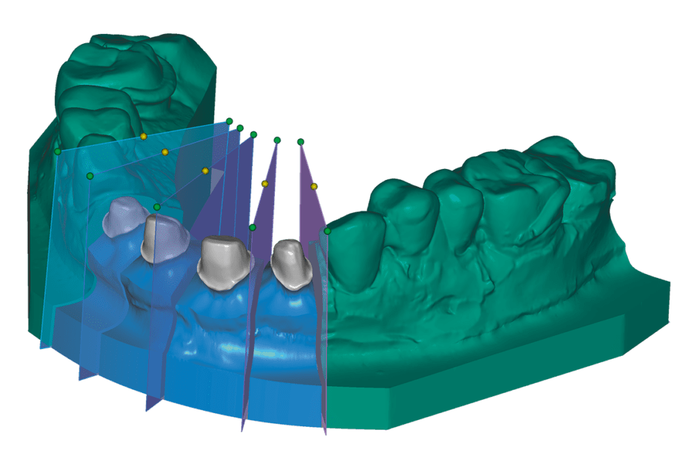 exocad | Nota3D